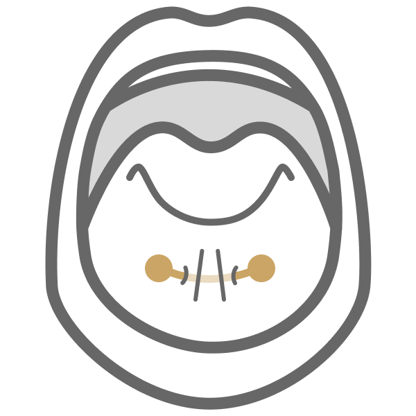 Tongue Tie Piercing – PiercingXXL